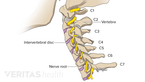 Pinched Nerve | Physical Therapy Treatments for Cervical Radiculopathy
