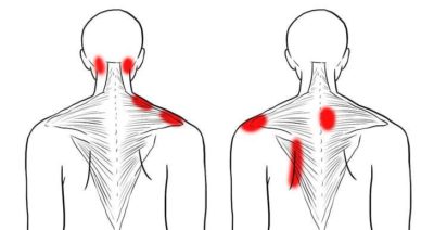 7 Tips For Neck & Shoulder Pain - The Doctors Of Physical Therapy